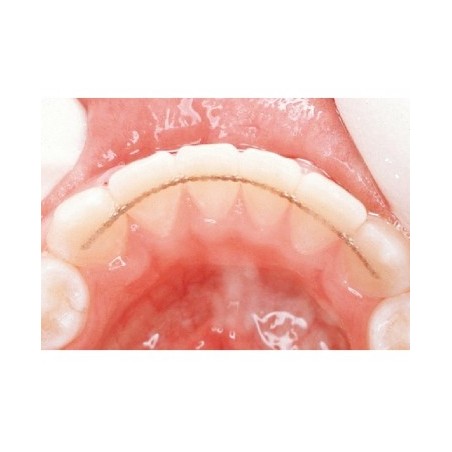 RETENEDOR ORTHO FLEXTECH ACERO INOXIDABLE
