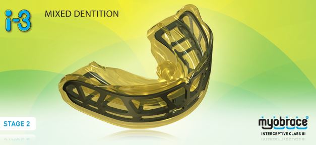 Myobrace para clase III (I-3)