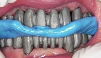 DeLar - Cera azul en láminas para Registro de Mordida