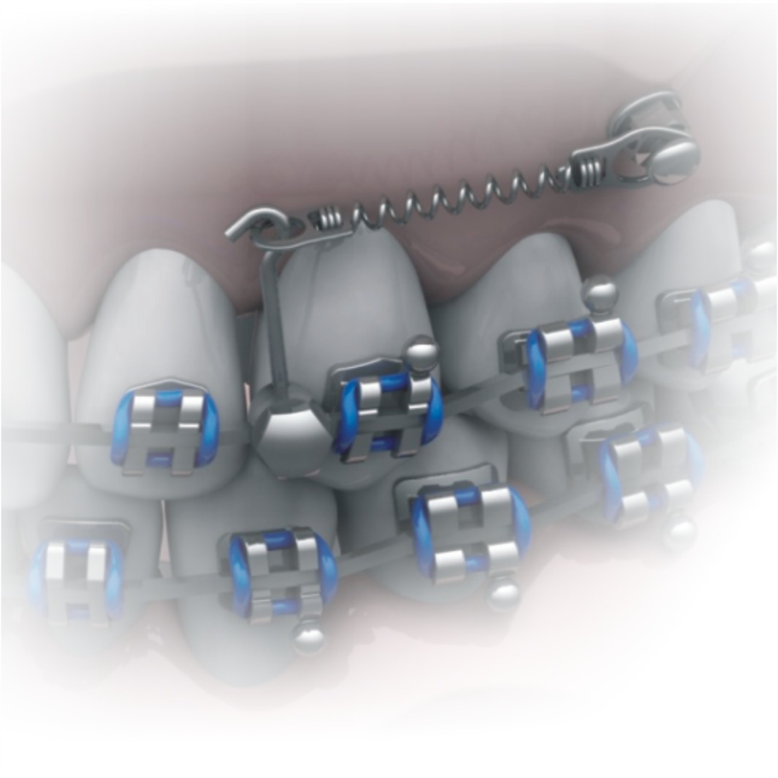 GURIN MORELLI BARRA LARGA CON GANCHO